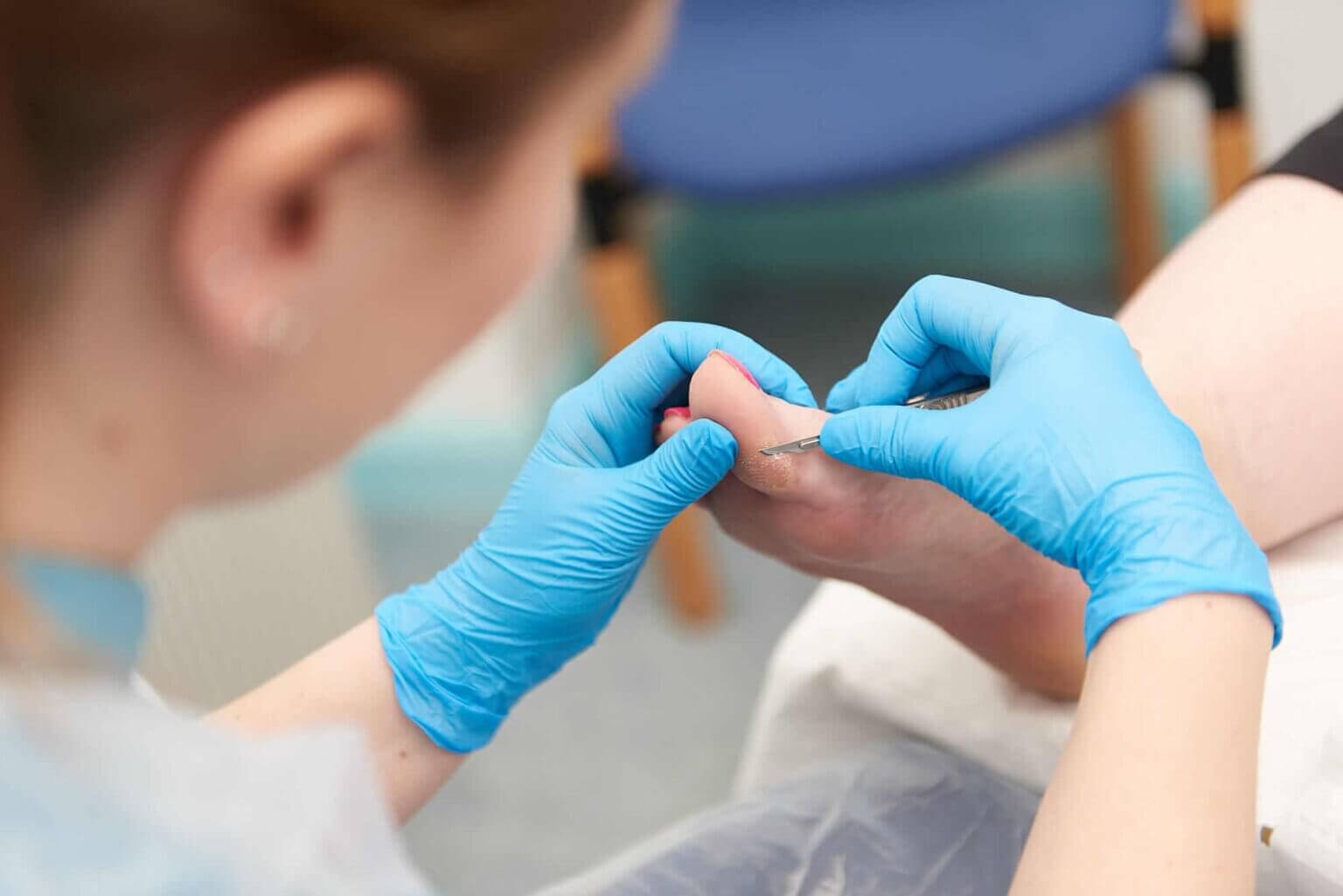 Foot Care Treatment | Foot Skin Care | Round House Podiatry